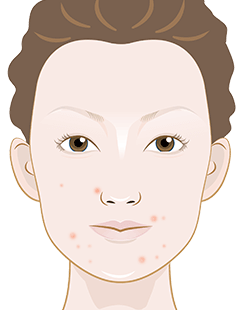 Your guide for blemished skin → How to get rid of it effectively