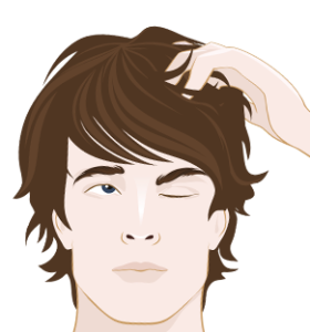 Seborrheic Dermatitis - Get Rid of Scalp Problems - Australian Bodycare